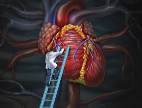 Manejo perioperatorio de los enfermos con insuficiencia cardíaca. Parte ...